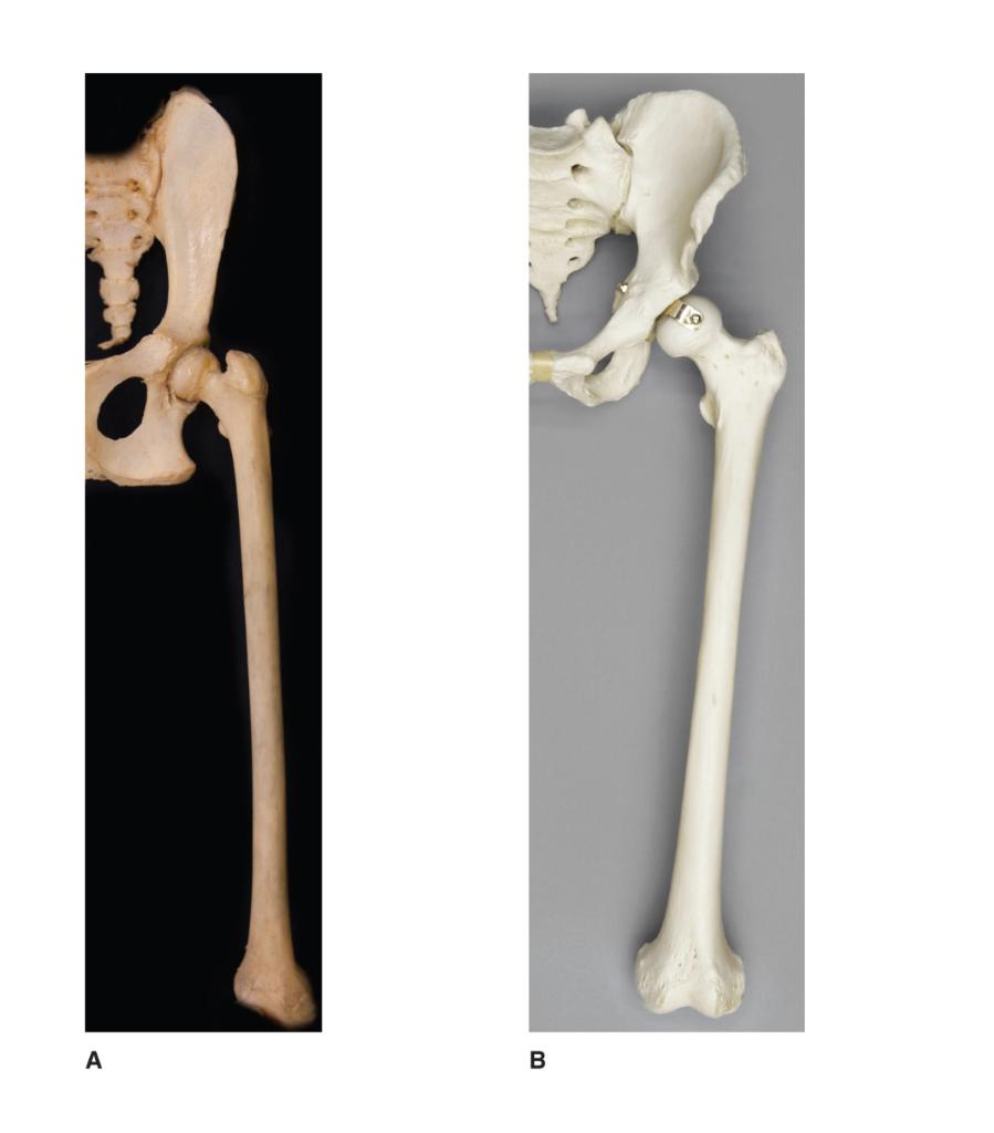 Exercise 5 Bipedal Adaptations of the Femur Examine the skeletal ...